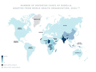 What Are Measles, Mumps & Rubella? Symptoms, Risks &… | Ready Health